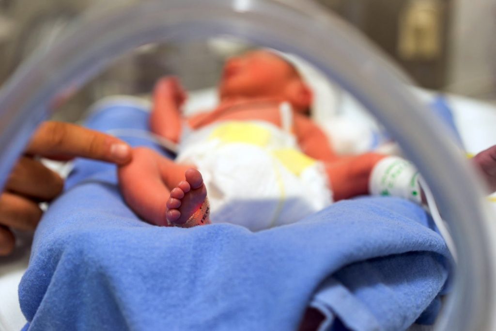 Penggunaan Alat Deteksi Kuning Non-Invasif untuk Prediksi Bayi Prematur ...