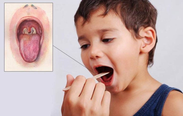 Peranan Model Seiqr pada Penyakit Difteri - Universitas Airlangga ...